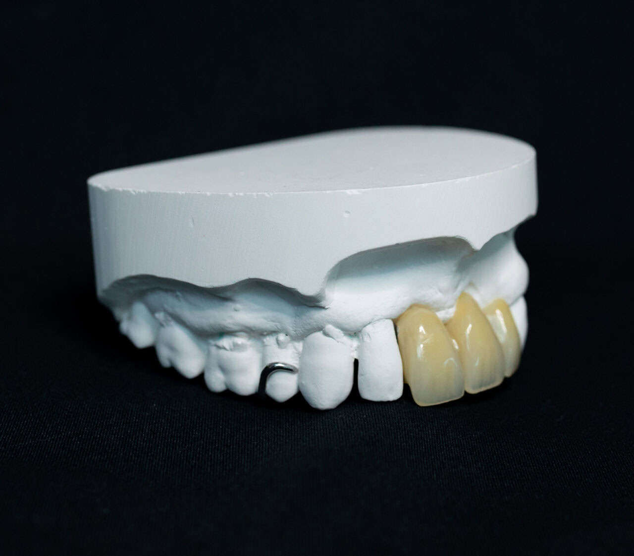 Dentures - Ocean Village Dental Clinic